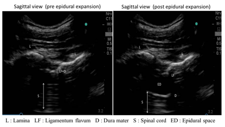 SPPM Newsletter- ASA Abstract Review 3